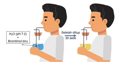 Perhatikan gambar percobaan berikut! Seor...